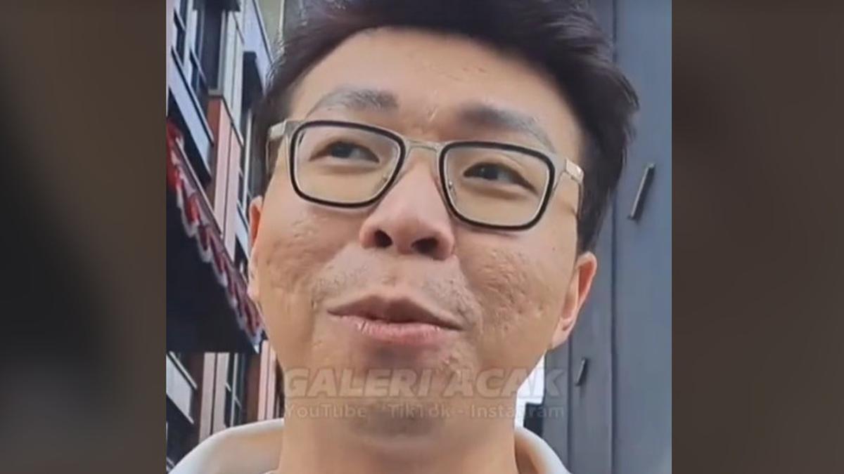 Penjelasan Richard Lee soal Wajahnya yang Tampak Bopeng Saat Tersorot ...