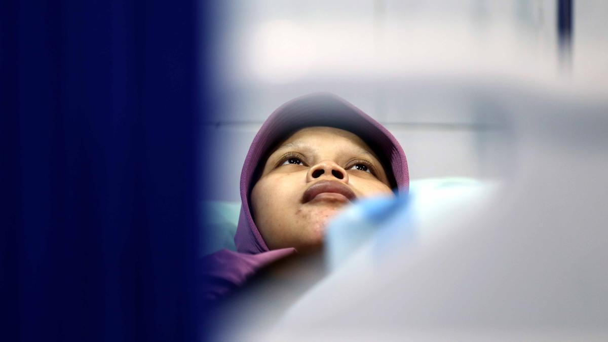 Belum Ada Obat yang Bisa Sembuhkan Sulami Si Manusia Kayu - Lifestyle ...