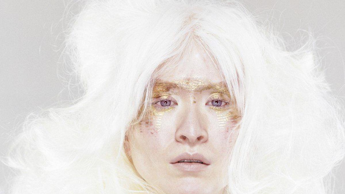Connie Chiu Model Albino Yang Mengubah Perbedaan Jadi Kelebihan Lifestyle