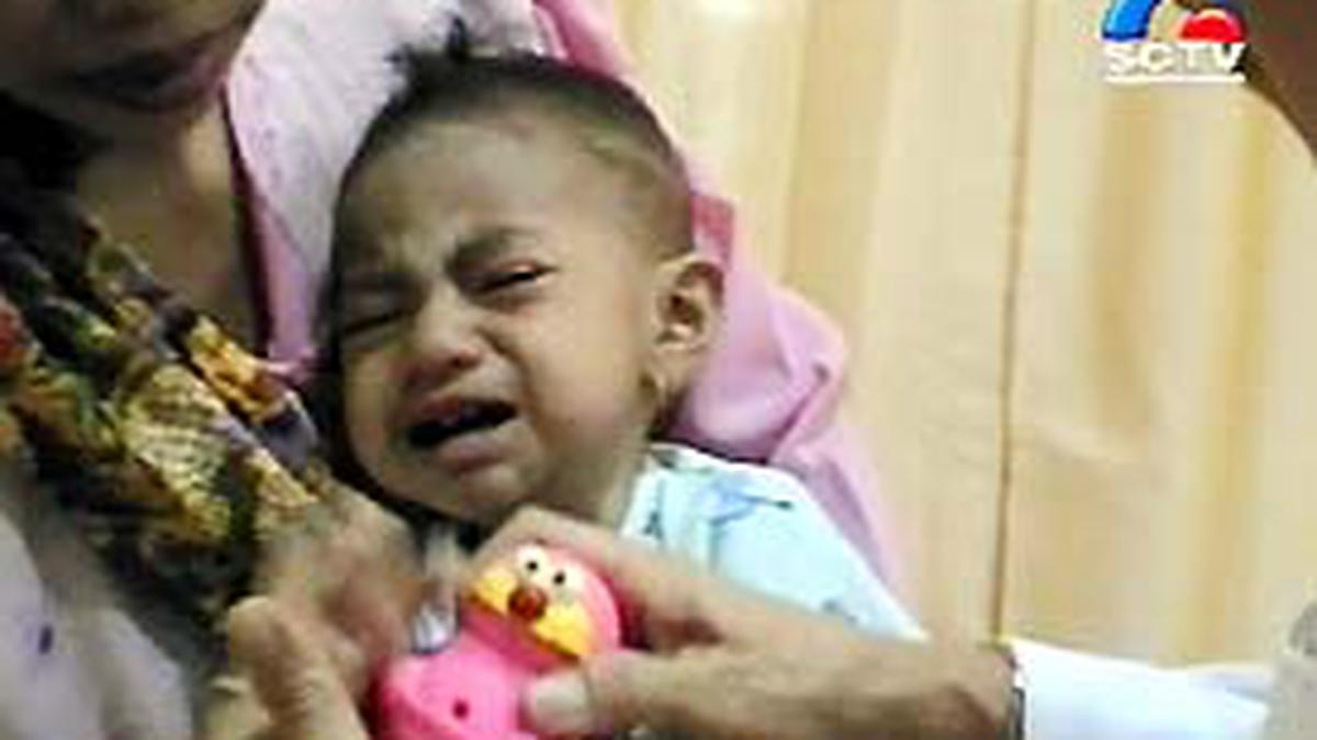 Cerebral Palsy, Virus Cacat Fisik Anak-Anak - News Liputan6.com