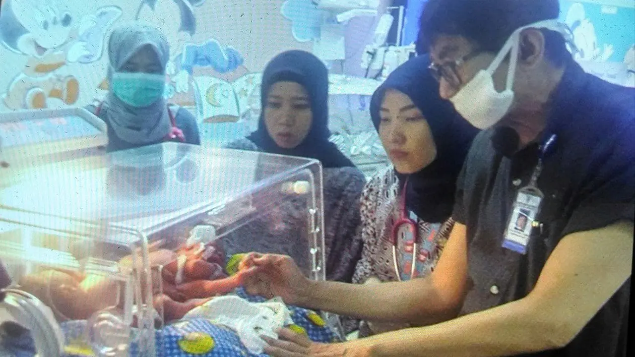 Kondisi Membaik, Bayi Kembar Siam Subang Siap Jalani Operasi Pemisahan - Health Liputan6.com