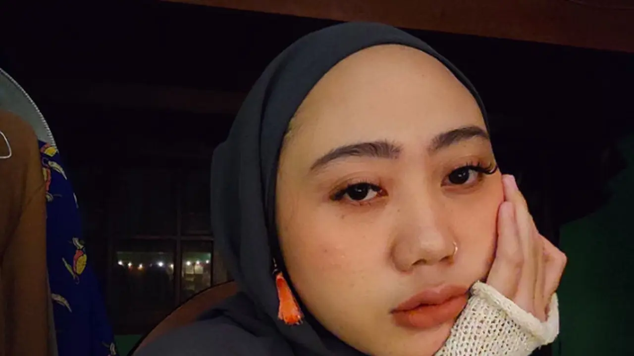 Aya Canina Eks Vokalis Tuntut Merek dan Hak Lagu Terhadap Personel Band ...