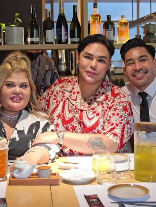 Potret Shindy Samuel Didukung Para Seleb Usai Operasi Potong Lambung - Foto Liputan6.com