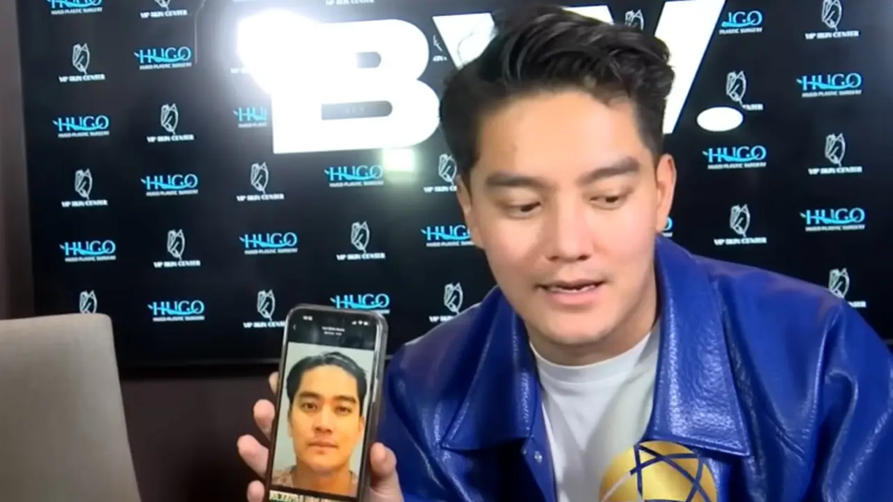 12 Potret Perubahan Bentuk Hidung Boy William Usai Jalani Operasi ...