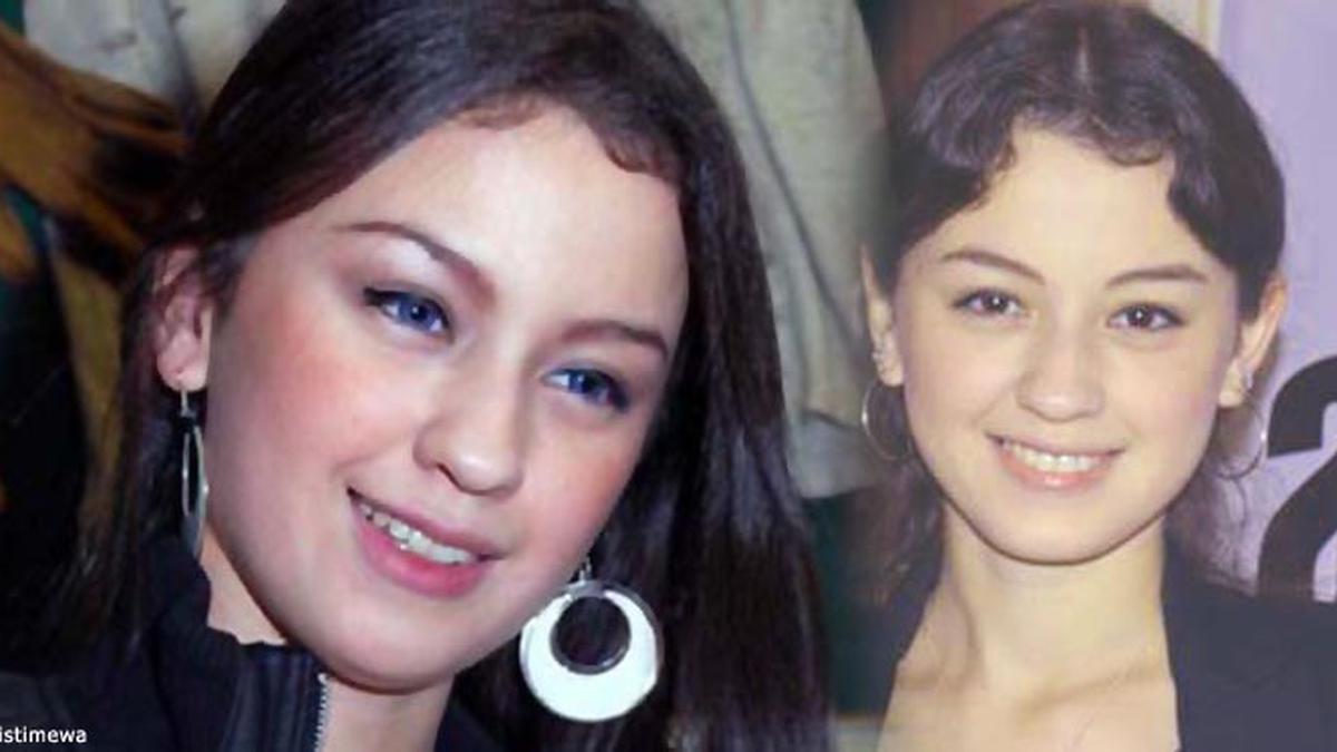 Gigi Tidak Rata, Kimberly Rider Niat Operasi - Page 2 - ShowBiz ...