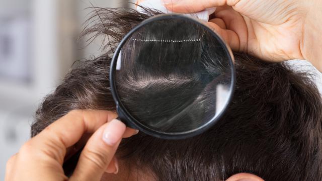 Adakah Dokter Spesialis Rambut? Inilah Dokter yang Tepat untuk ...