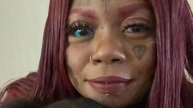 Nekat Tato Bola Mata, Ibu Lima Anak Kini Jadi Buta - Lifestyle Liputan6.com