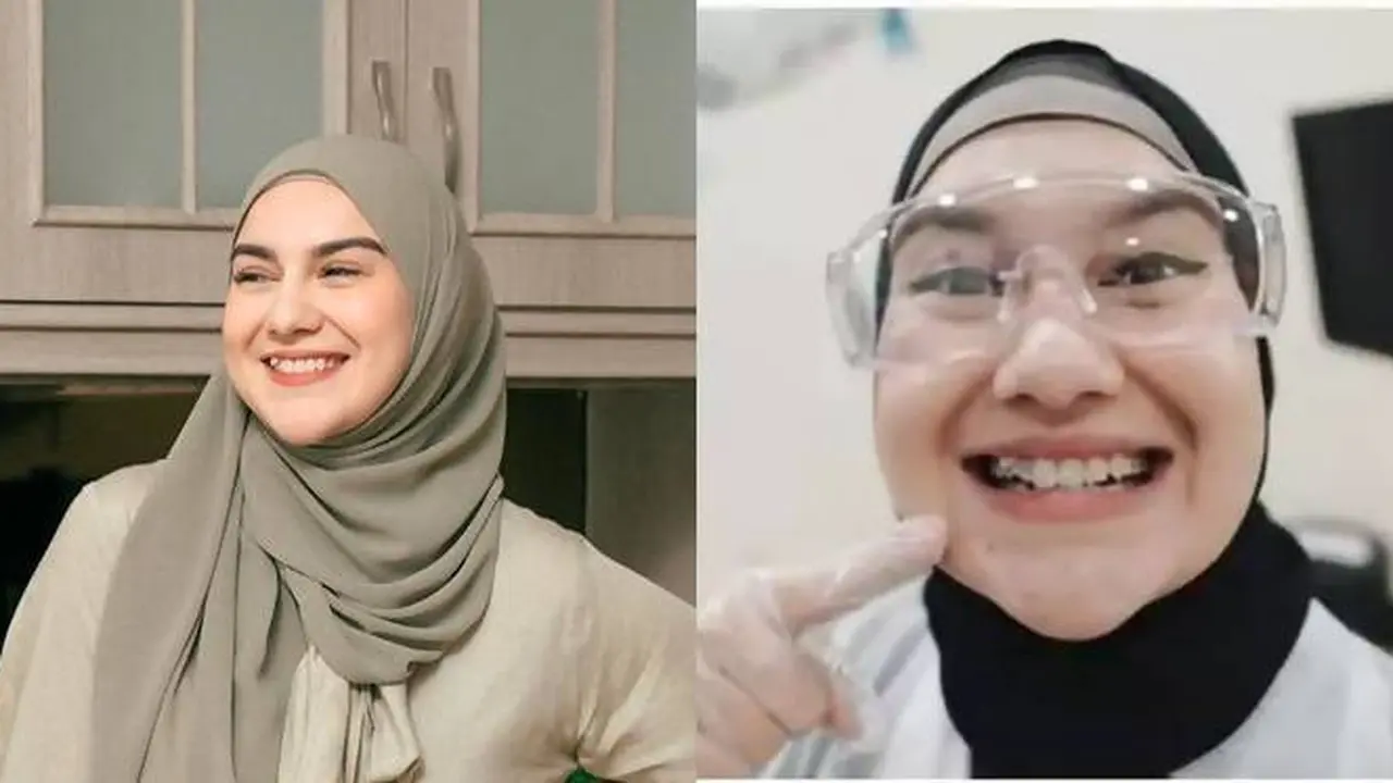 Potret 6 Artis Sebelum dan Sesudah Hilangkan Gigi Gingsul, Tuai ...