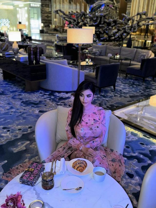Sesal Influencer yang Habiskan Rp15,5 Miliar demi Bokong Mirip Kim ...