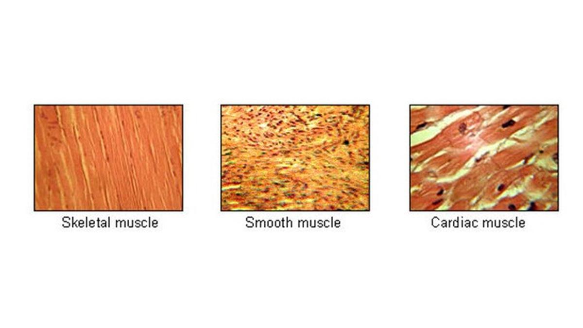 Otot Polos adalah Otot yang Dikontrol Saraf Tak Sadar, Ini Bedanya ...