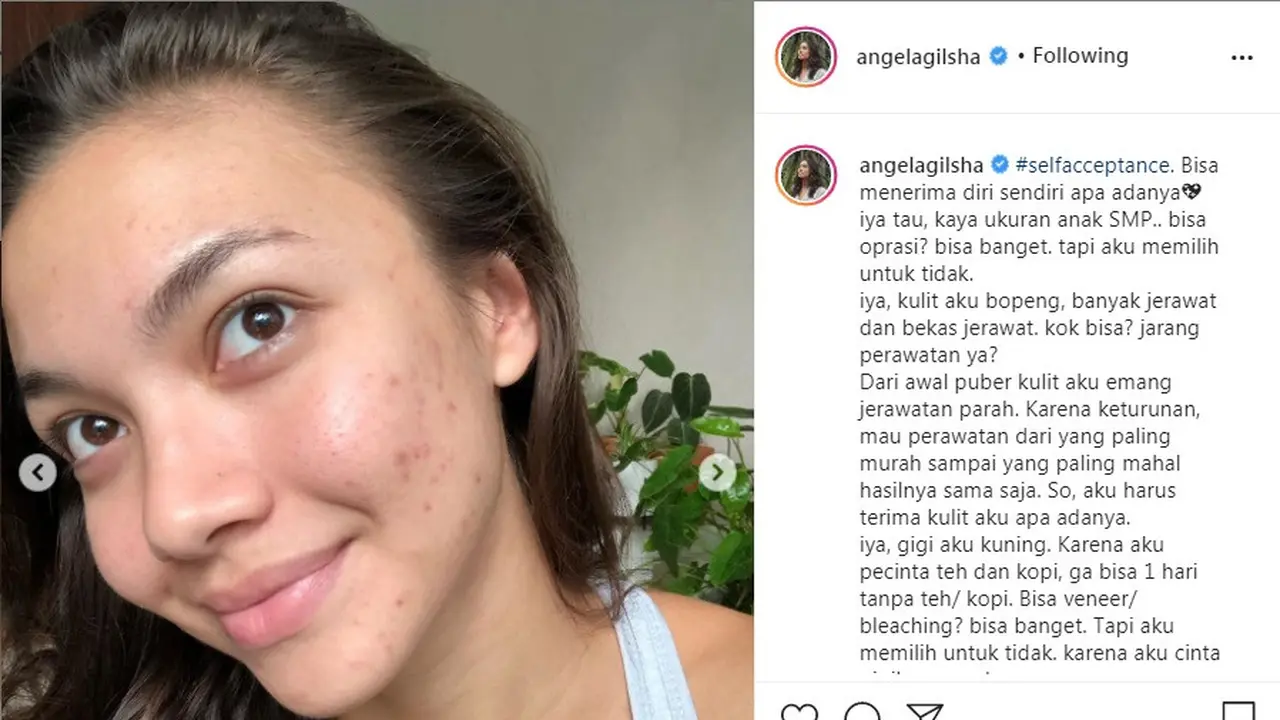 Angela Gilsha Tak Enak Hati Dibilang Cantik Banget, Bongkar Kekurangan Diri - ShowBiz Liputan6.com