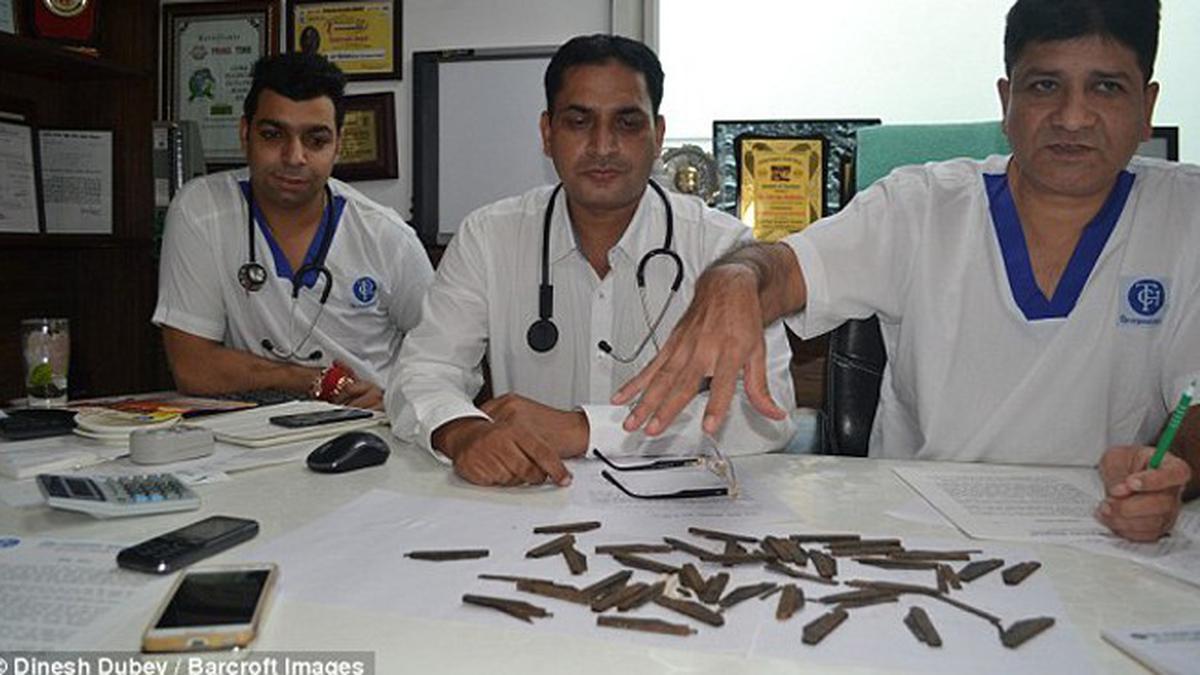 Kisah Jarnail, Laki-Laki Pemakan Pisau dari India - Citizen6 Liputan6.com