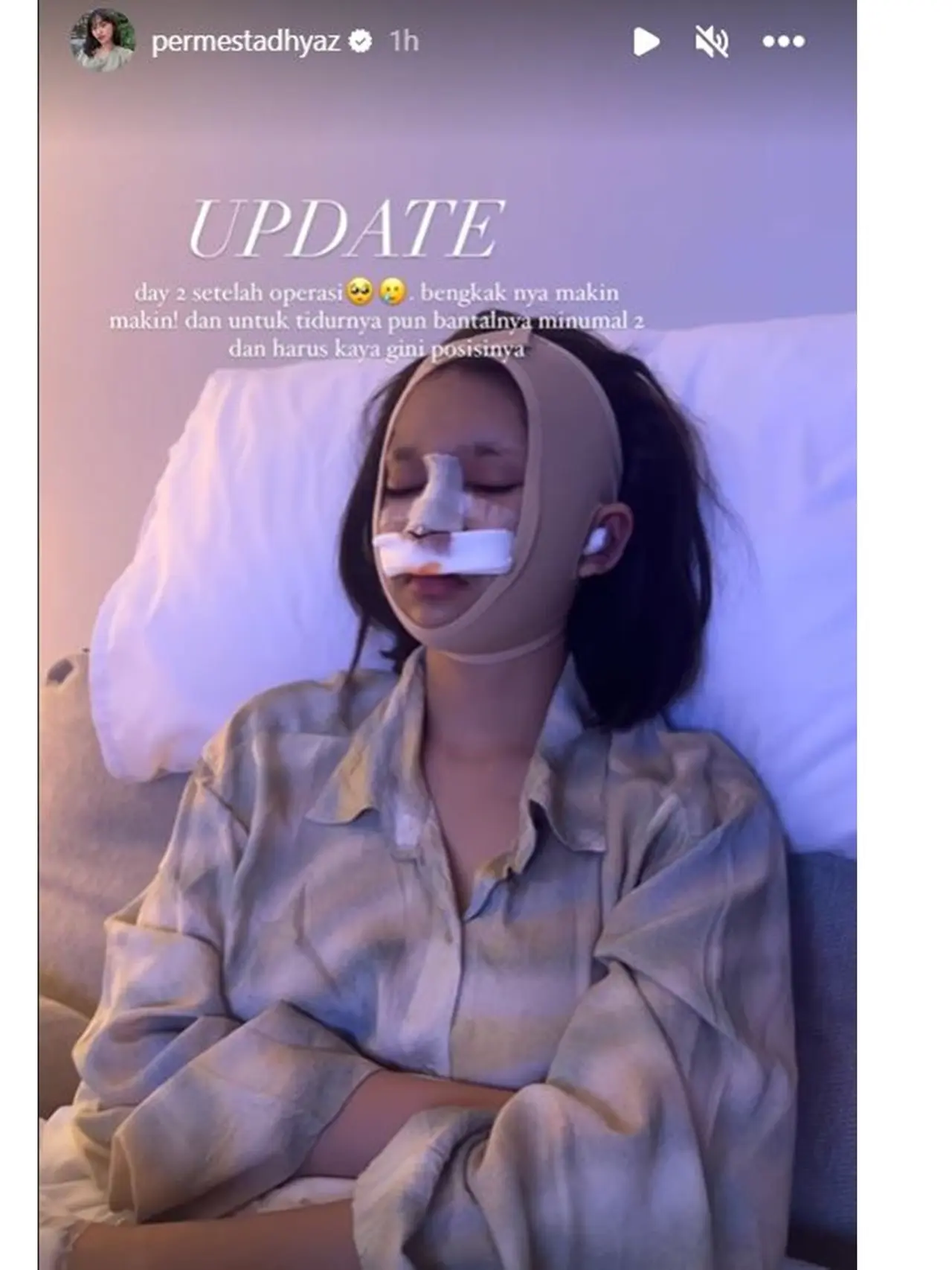 6 Potret Permesta Dhyaz Anak Farida Nurhan Oplas Hidung Lagi, Dulu ...