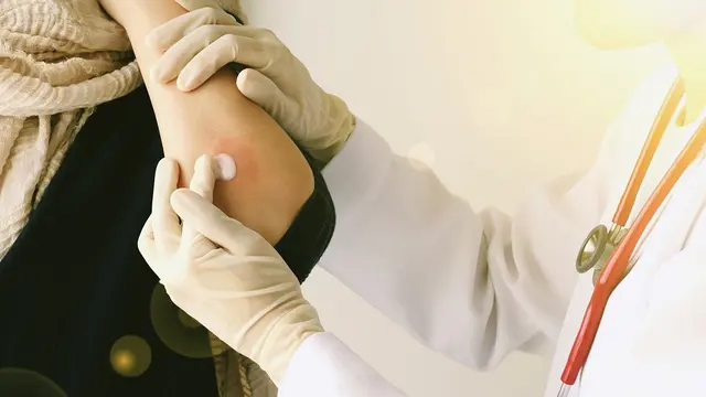 Mengenal Macam-macam Dermatitis, Apa Saja Penyebabnya? - Hot Liputan6.com