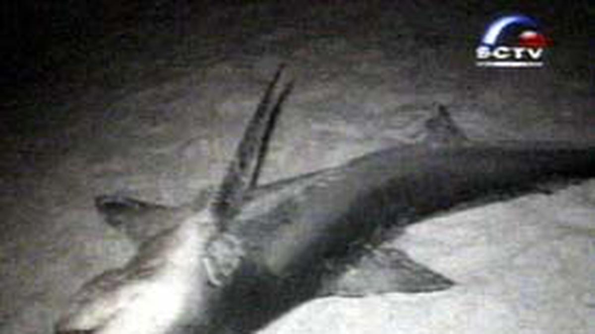 Lengan Bocah yang Dimakan Hiu Berhasil Disambung - Global Liputan6.com