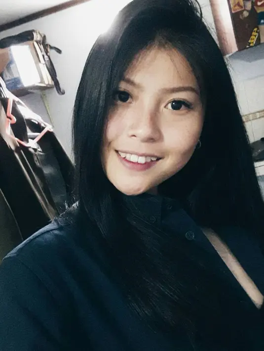 Foto Lawas Mitzi Abigail Kekasih Anthony Ginting Sebelum Pakai Behel ...