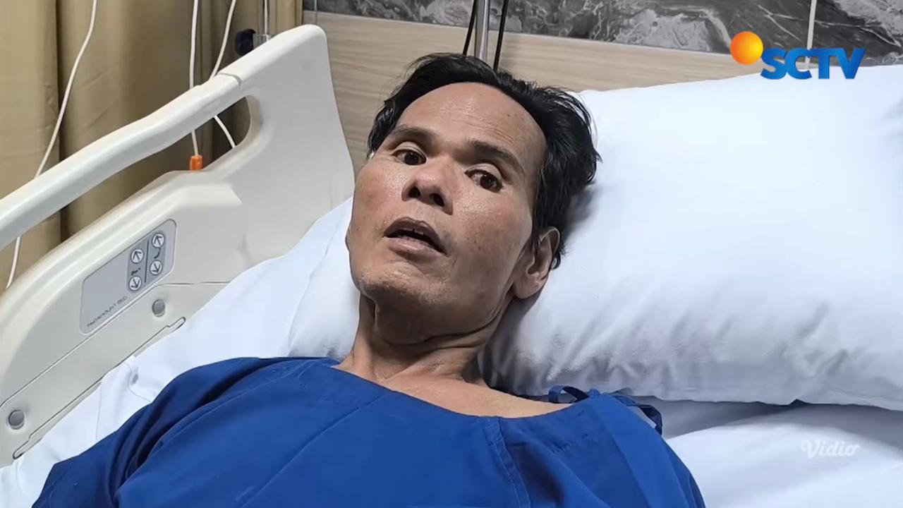 Pengakuan Fahmi Bo Frustrasi Tak Kunjung Sembuh, Akibat Batu Empedu dan ...