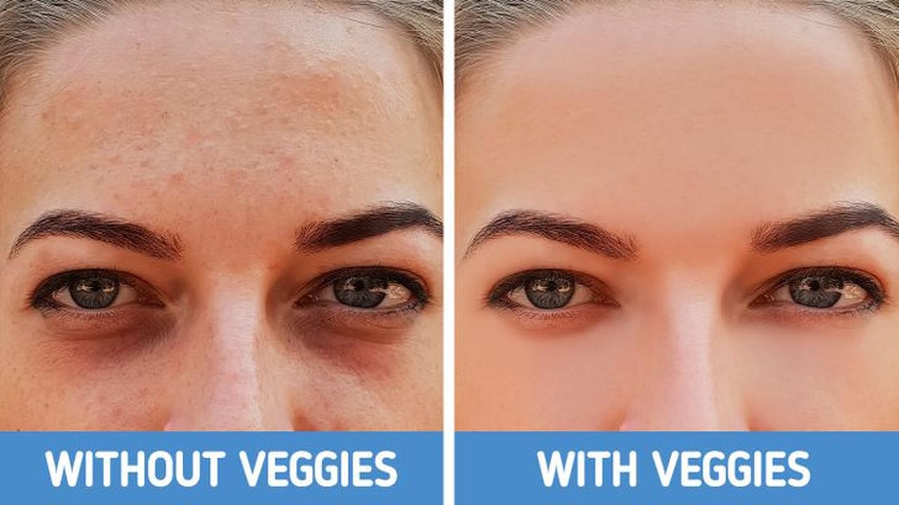 Kenali 4 Jenis Lingkaran Hitam di Bawah Mata dan Cara Tepat Mengatasinya