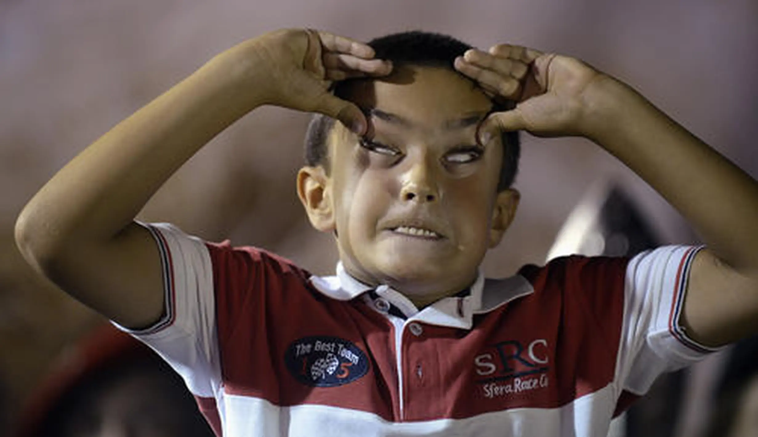 Kontes Foto Wajah Paling Jelek Sedunia - Photo Fimela.com