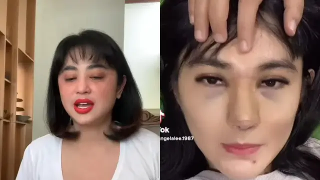 7 Potret Artis Ini Wajahnya Terlihat Bengkak Usai Operasi, Bikin ...
