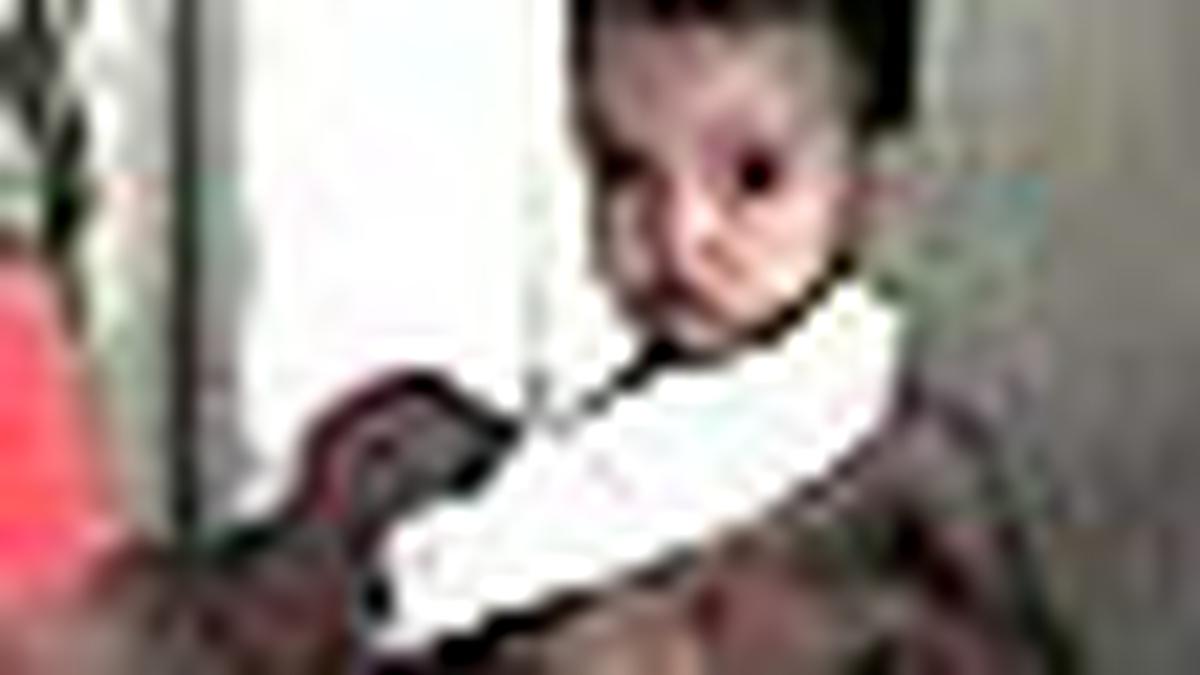 Kasus Busung Lapar di Daerah Masih Marak - News Liputan6.com