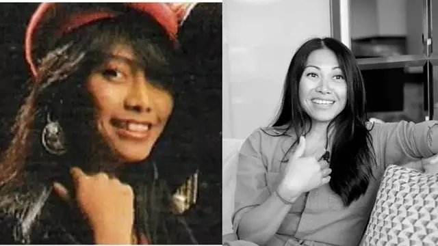 Potret 6 Artis Sebelum dan Sesudah Hilangkan Gigi Gingsul, Tuai ...