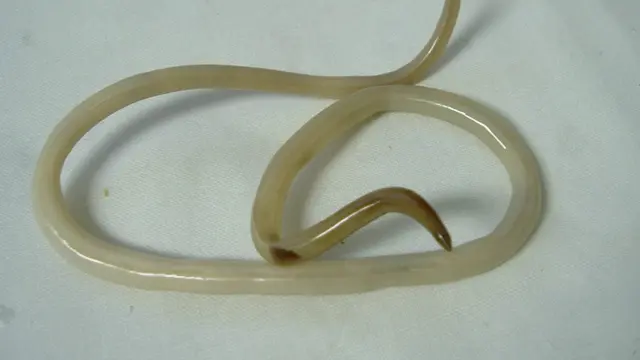 Waspada, Ini 3 Cara Penularan Cacing - Health Liputan6.com