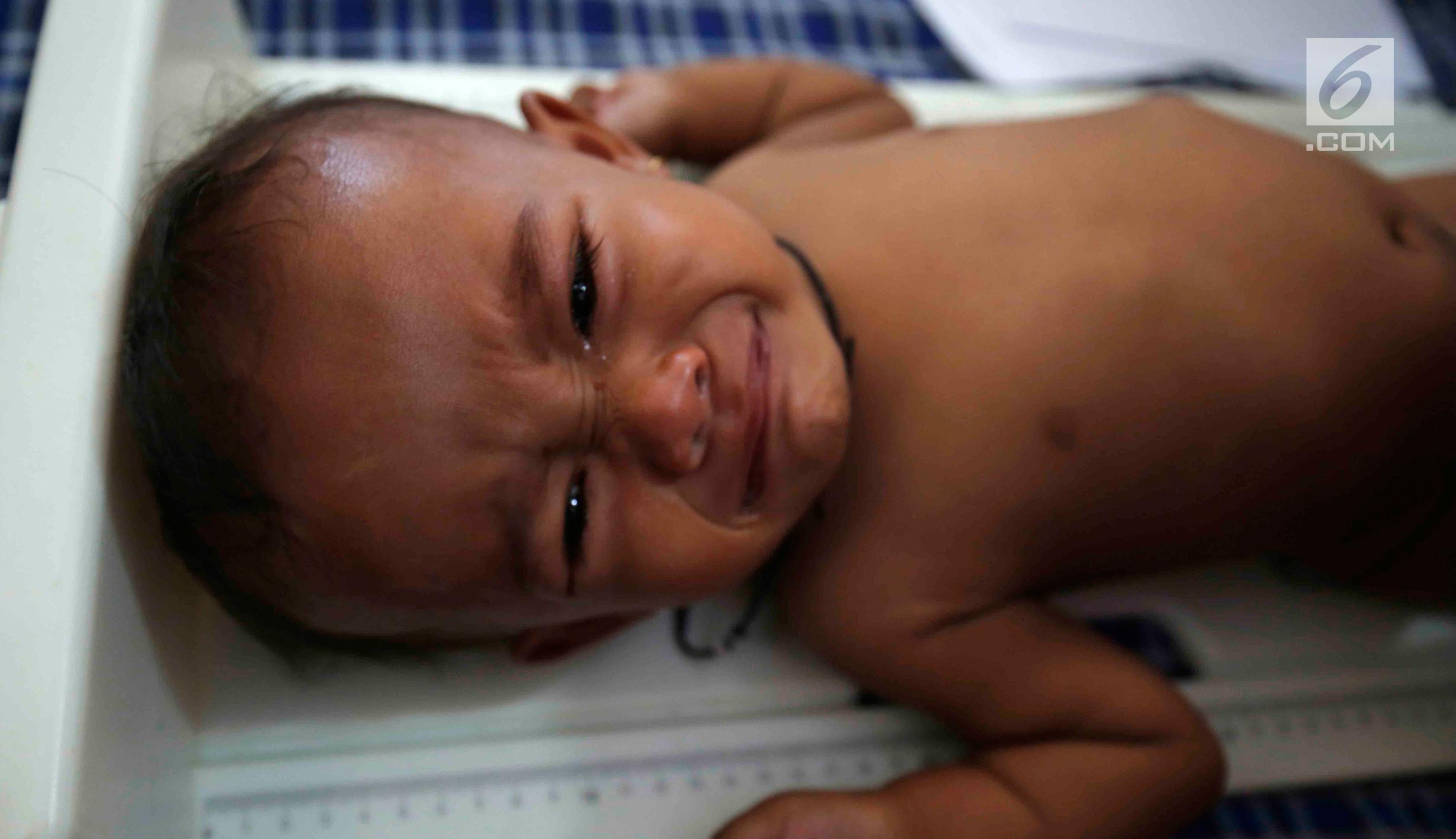 FOTO: Melihat Kondisi Anak-Anak Kurang Gizi di Pandeglang