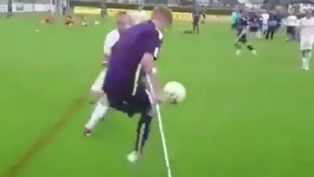 Punya Satu Kaki, Eks Wonderkid ManCity Cetak Gol Indah - Bola Liputan6.com