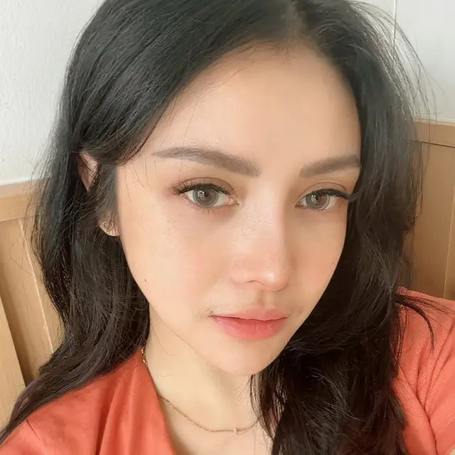 Habiskan Rp 521 Juta Untuk Oplas, Ini 6 Potret Terbaru Mawar AFI Bikin ...