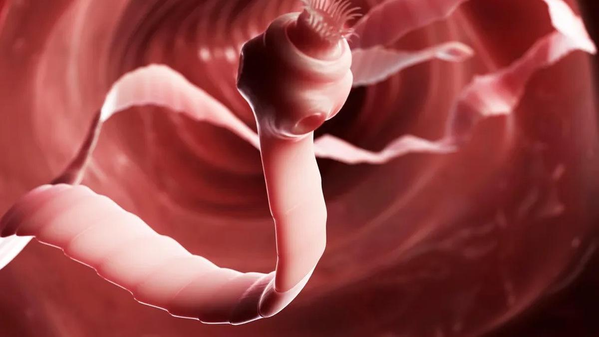 Ngeri! Wanita Ini Minum Pil Berisi Telur Cacing Pita Babi Demi Diet ...