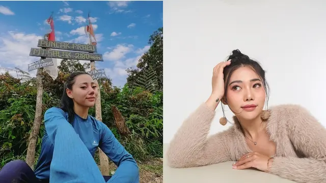 7 Potret Terbaru Wendy Walters Disebut Oplas, Hidung dan Pipi Jadi Sorotan - Hot Liputan6.com