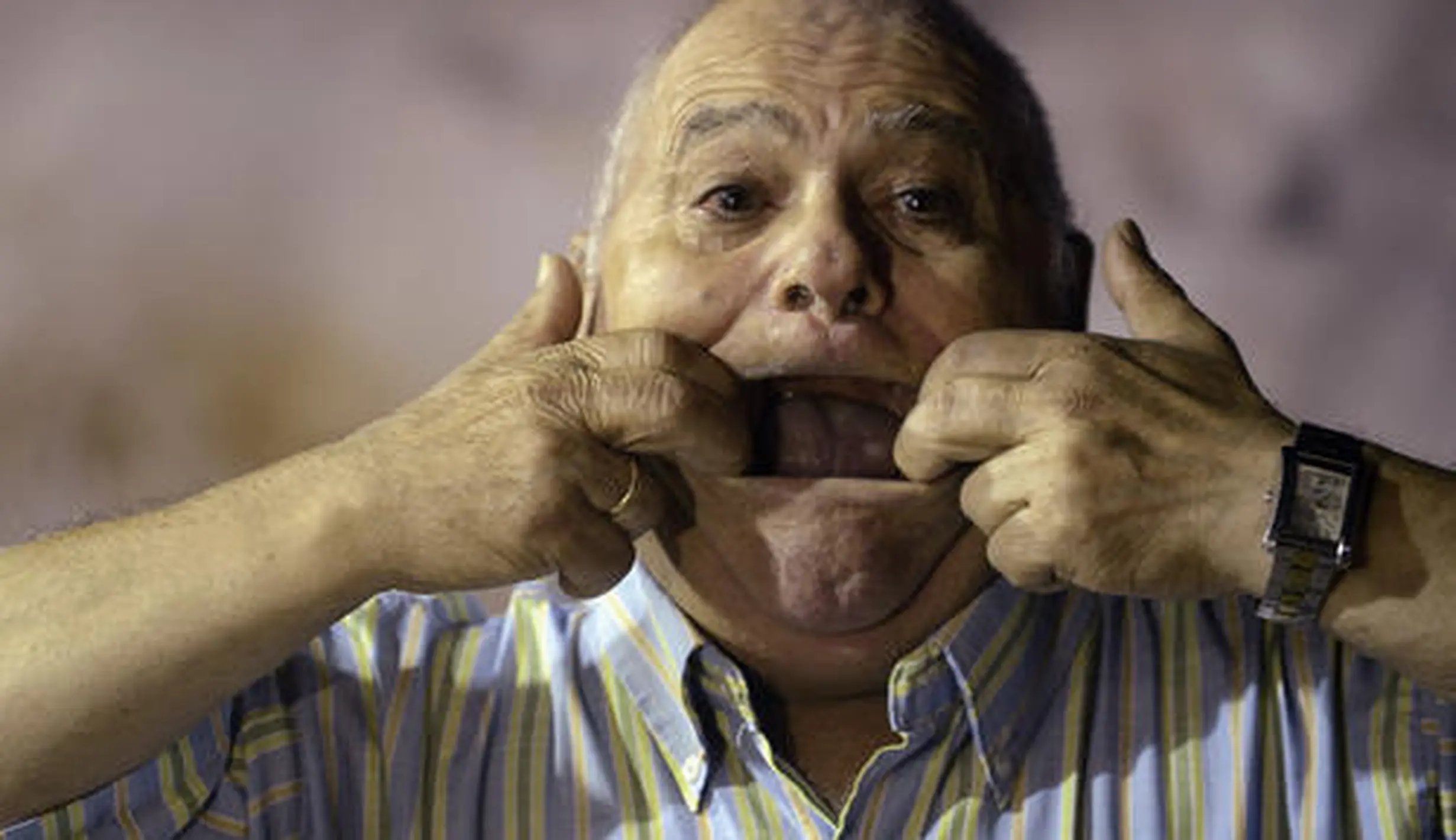 Kontes Foto Wajah Paling Jelek Sedunia - Photo Fimela.com