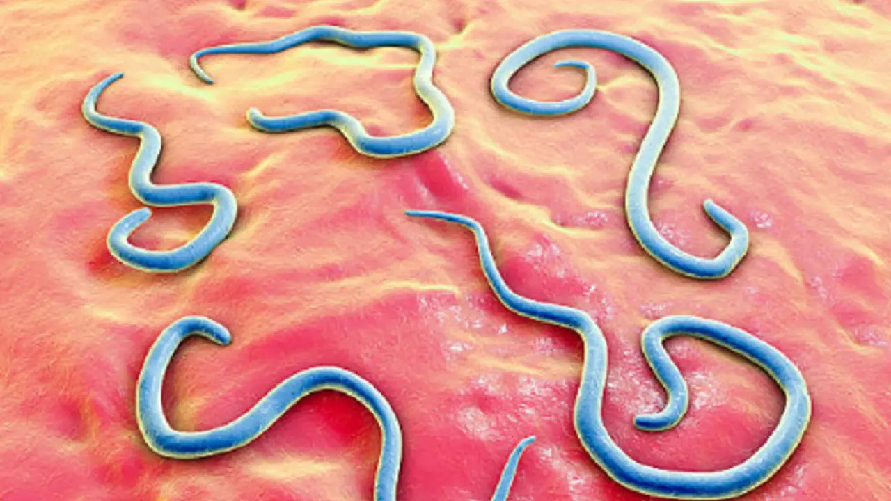 5 Ciri-ciri Anak Cacingan yang Perlu Diketahui, Jangan Anggap Remeh ...