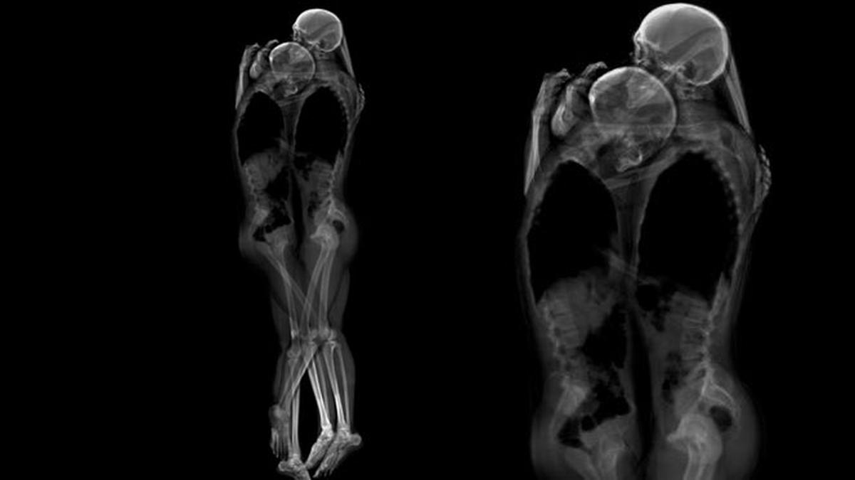 Kreatif! Seniman Ini Memotret Dengan Mesin X-ray - Tekno Liputan6.com