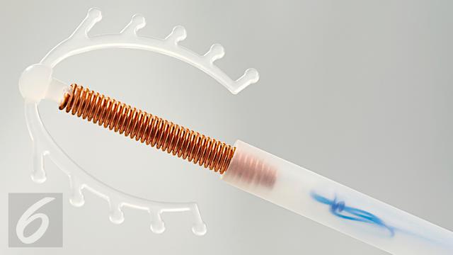Gunakan KB IUD, Apa Pengaruhnya pada Hubungan Seks? - Health Liputan6.com