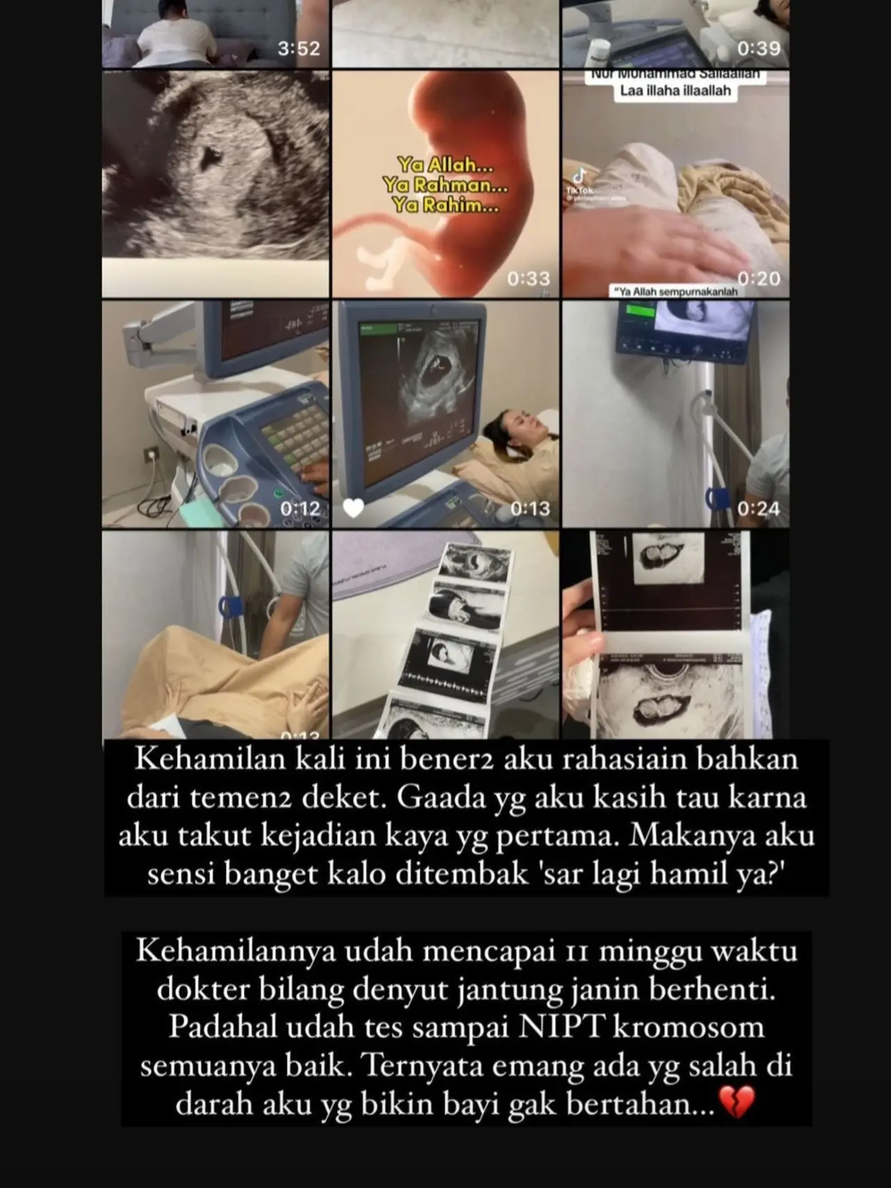 7 Potret Sarah Gibson Keguguran Janin Dua Kali, Sempat Dirahasiakan ...