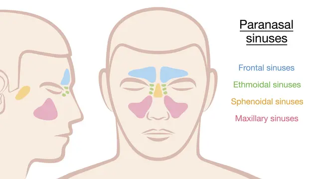 Mengenal Penyakit Sinusitis, Penyebab dan Cara Penanganannya - Health ...