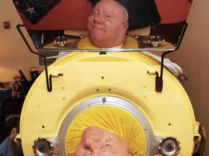 Pria Ini Manusia Terakhir di Dunia yang Gunakan Paru-Paru Besi ...