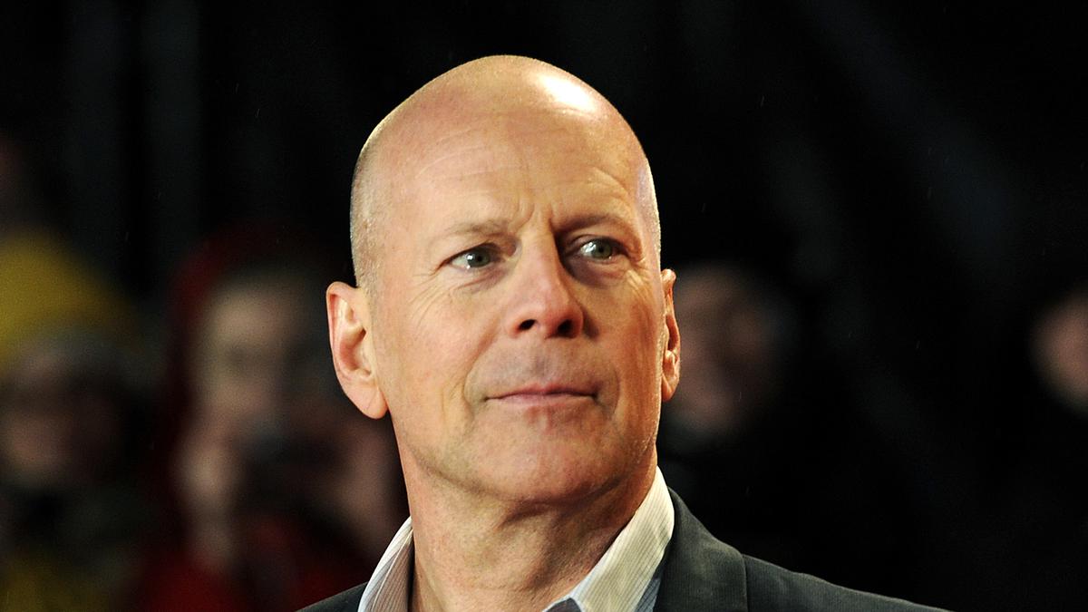 Pria Botak Lebih Cerdas dan Sukses? - Health Liputan6.com