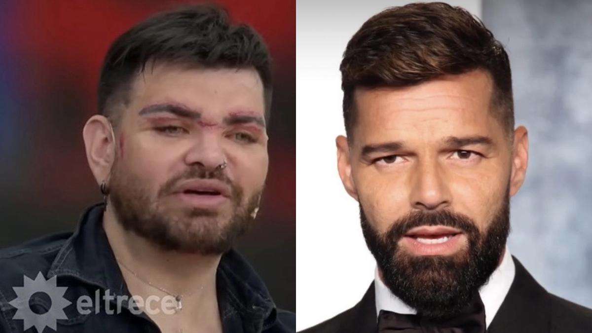Pria Argentina Rela 40 Kali Bedah Kosmetik Agar Mirip Ricky Martin ...