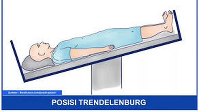 Mengenal Posisi Trendelenburg, Manfaat, dan Langkahnya dalam Dunia Medis