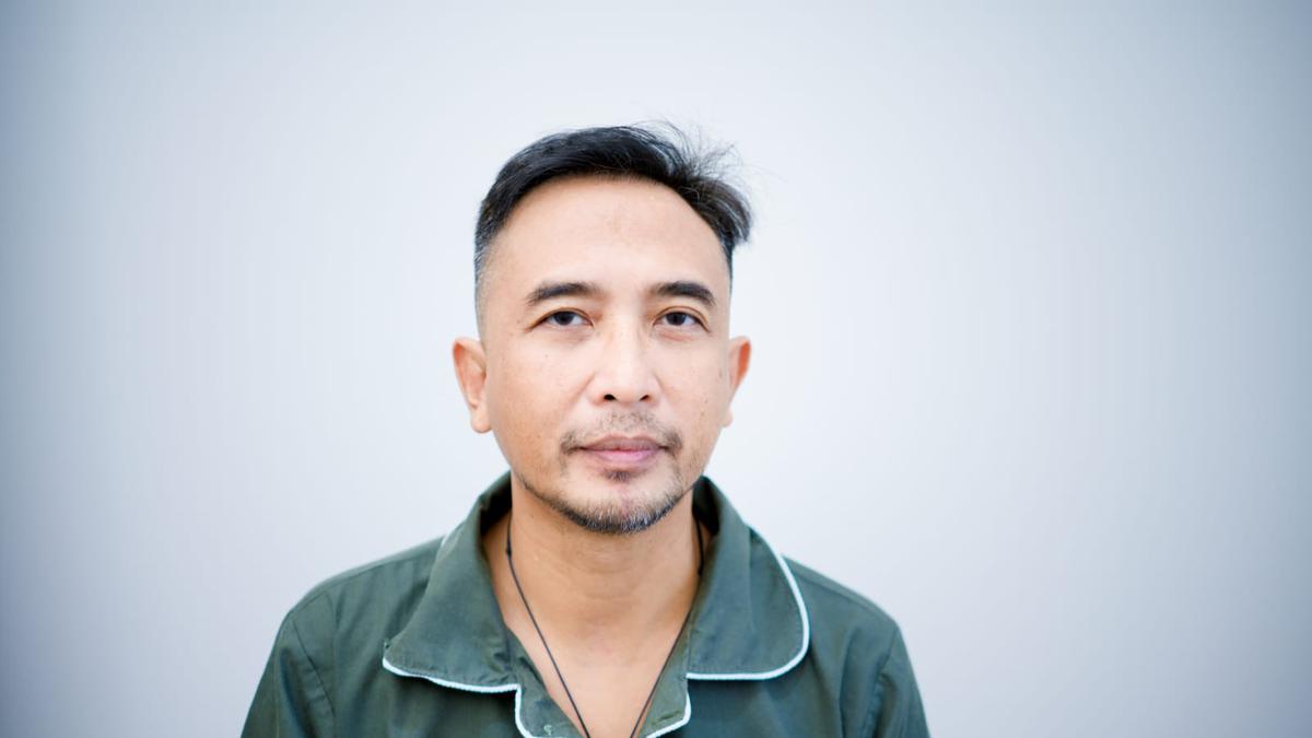 Piyu Padi Reborn Tak Pakai Topi Lagi setelah Transplantasi Rambut, Kini ...