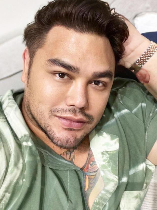 Ivan Gunawan Siap Operasi Dada Usai Berat Badan Turun 20 Kg, Syarat dan ...