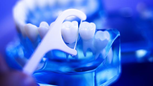 Ingin Punya Gigi yang Rapi Tapi Tidak Ingin Pakai Behel? Yuk Ikuti Cara ...