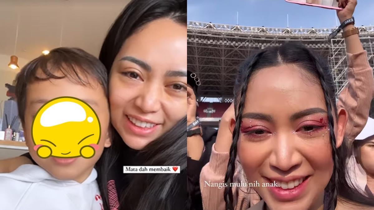 7 Potret Rachel Vennya Oplas Sedot Lemak Pipi, Hasilnya Makin Tirus ...