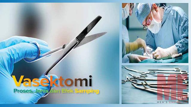 Mengenal Vasektomi, Prosedur Kontrasepsi Permanen untuk Laki-laki - Hot ...