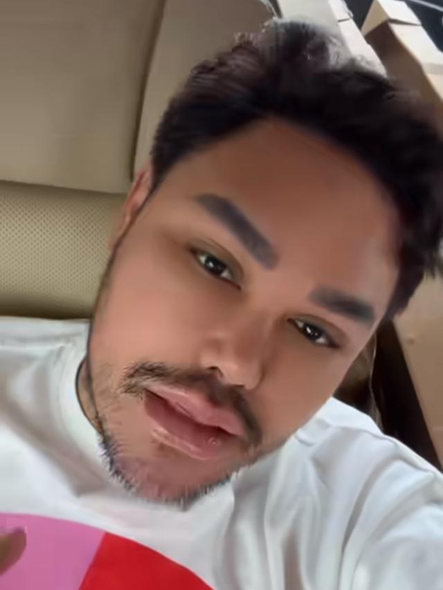 7 Potret Ivan Gunawan Tampil Macho Hasil Tarik Benang di Leher