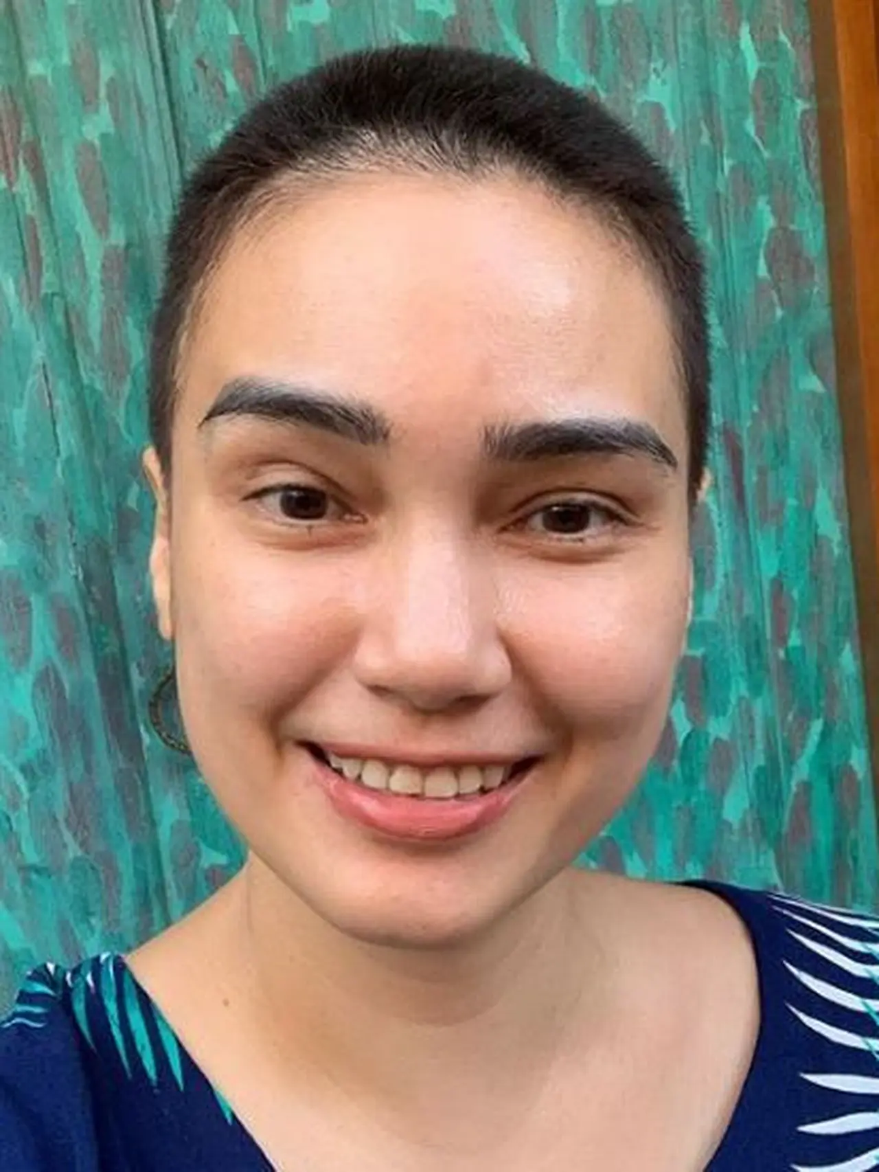 Feby Febiola Ceritakan Ketakutannya Saat Hadapi Sakit yang Diderita ...