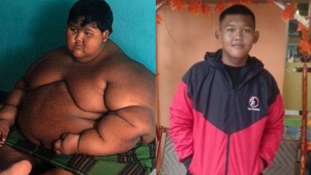 6 Potret Transformasi Arya Permana Bocah Viral Berbobot Nyaris 200 Kg, Bikin Takjub - Hot ...